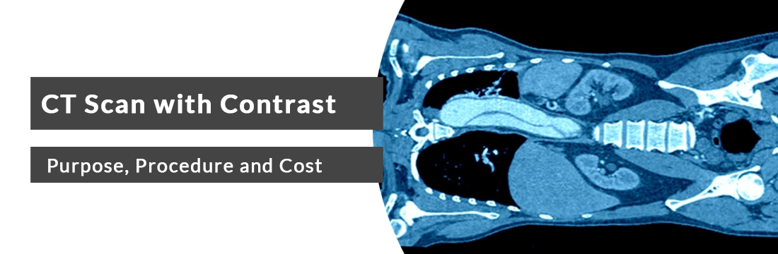 CT Scan With Contrast Purpose Procedure And Cost CT Scan With Contrast Purpose Procedure And Cost
